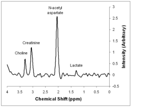 Brain MRI Spectroscopy - DocNeuro